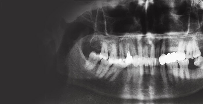 בלוטות רוק – ד"ר מיכאל אלתרמן